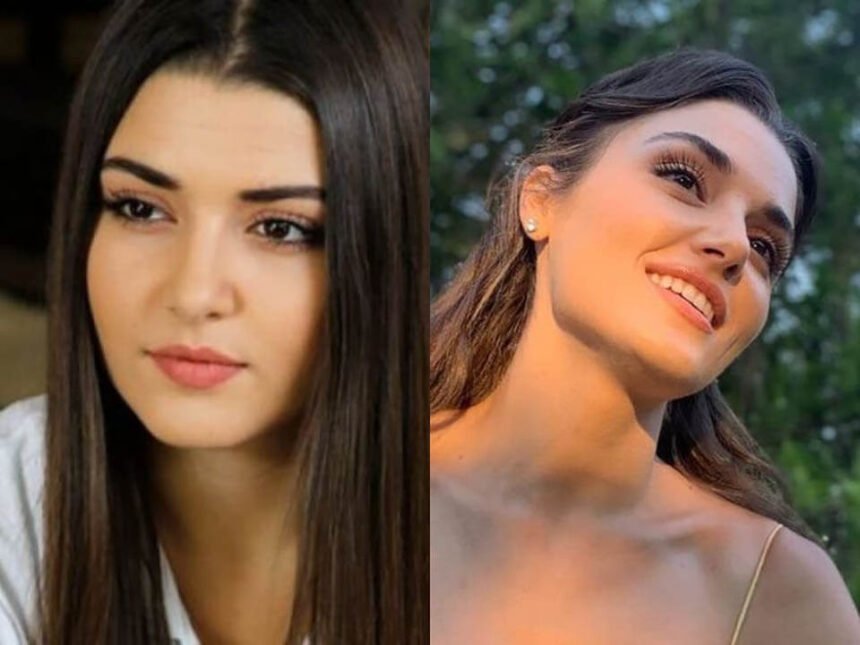 Before and After: Hande Ercel Plastic Surgery | Turkish Actors
